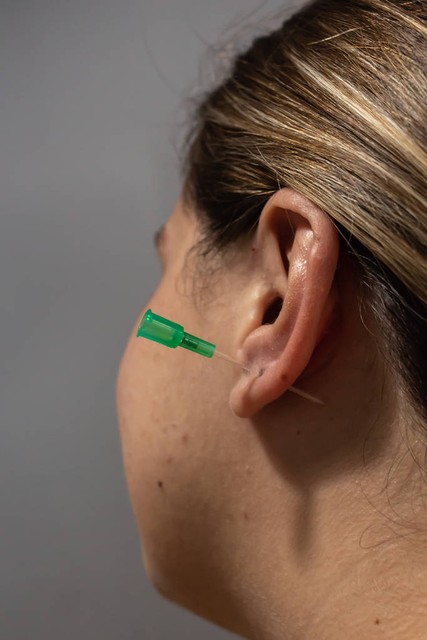 There is a small hole in the ear, called "Darwin's tubercle", what ...