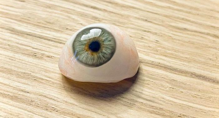 Can the prosthetic eye rotate? How much does it cost to wear a ...