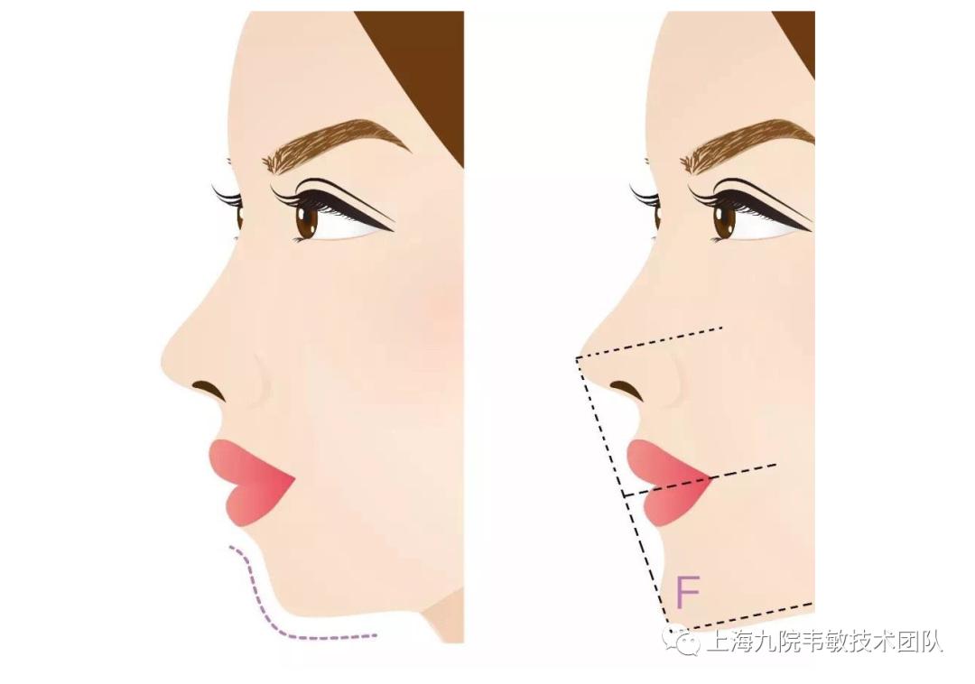 Why is there no clear dividing line between the chin and the neck? - iNEWS