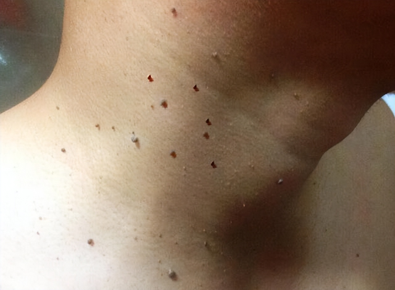 What is the reason for the "small meat particles" in the neck and ...