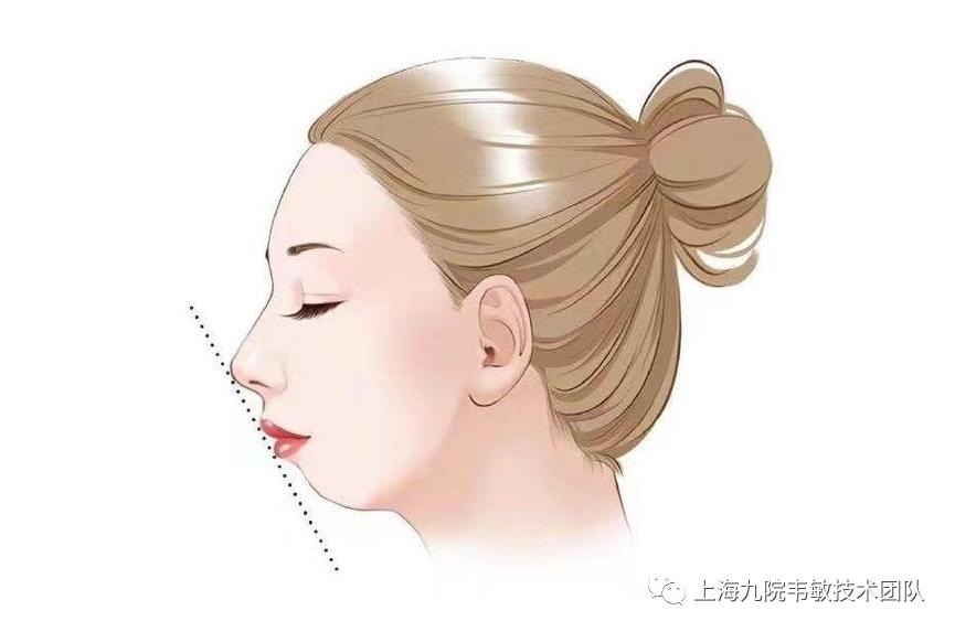 How to distinguish between a short chin and a receding chin? - iMedia