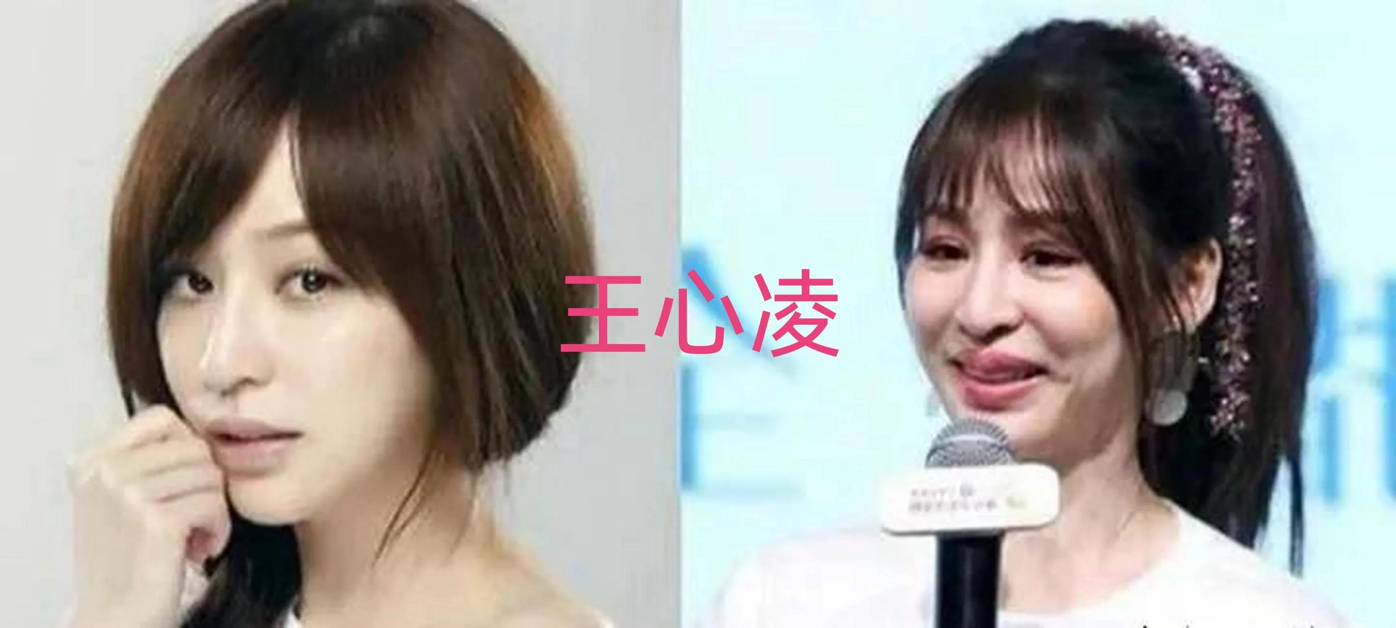 Who is the most regrettable of the top ten failed plastic surgery stars ...