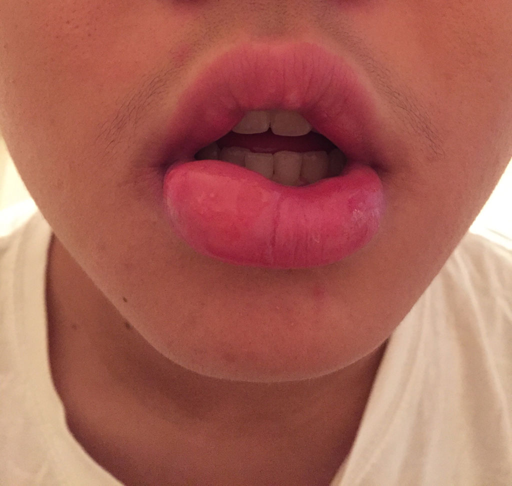 The child always likes to bite things? "Bit your nails" and "bit your ...