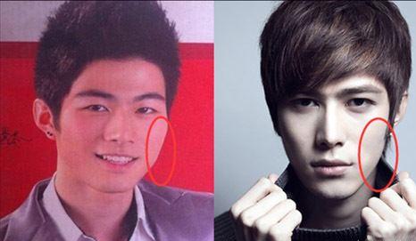There is a huge gap between the actor before and after plastic surgery ...