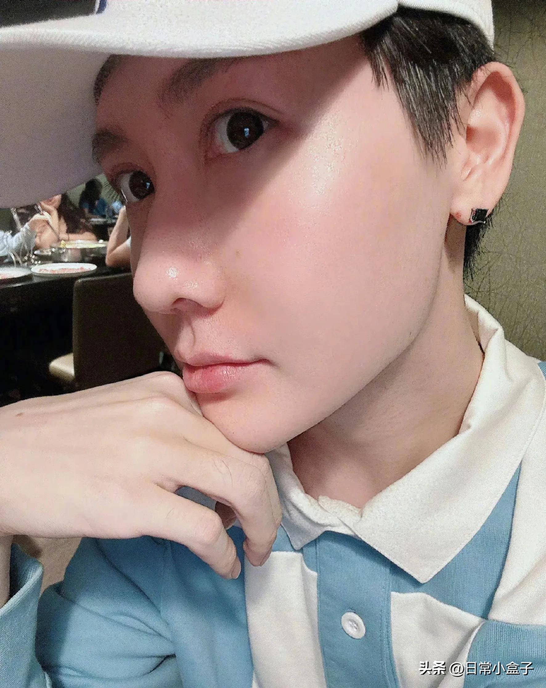 Liu Zichen, who was once known as the king of artificial plastic surgery, has become more and ...