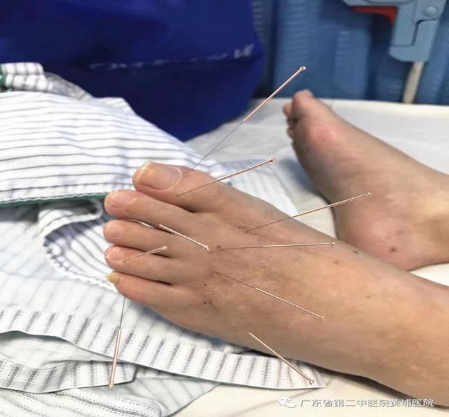 "China Comatose Awakening and Rehabilitation Alliance" shares Professor ...