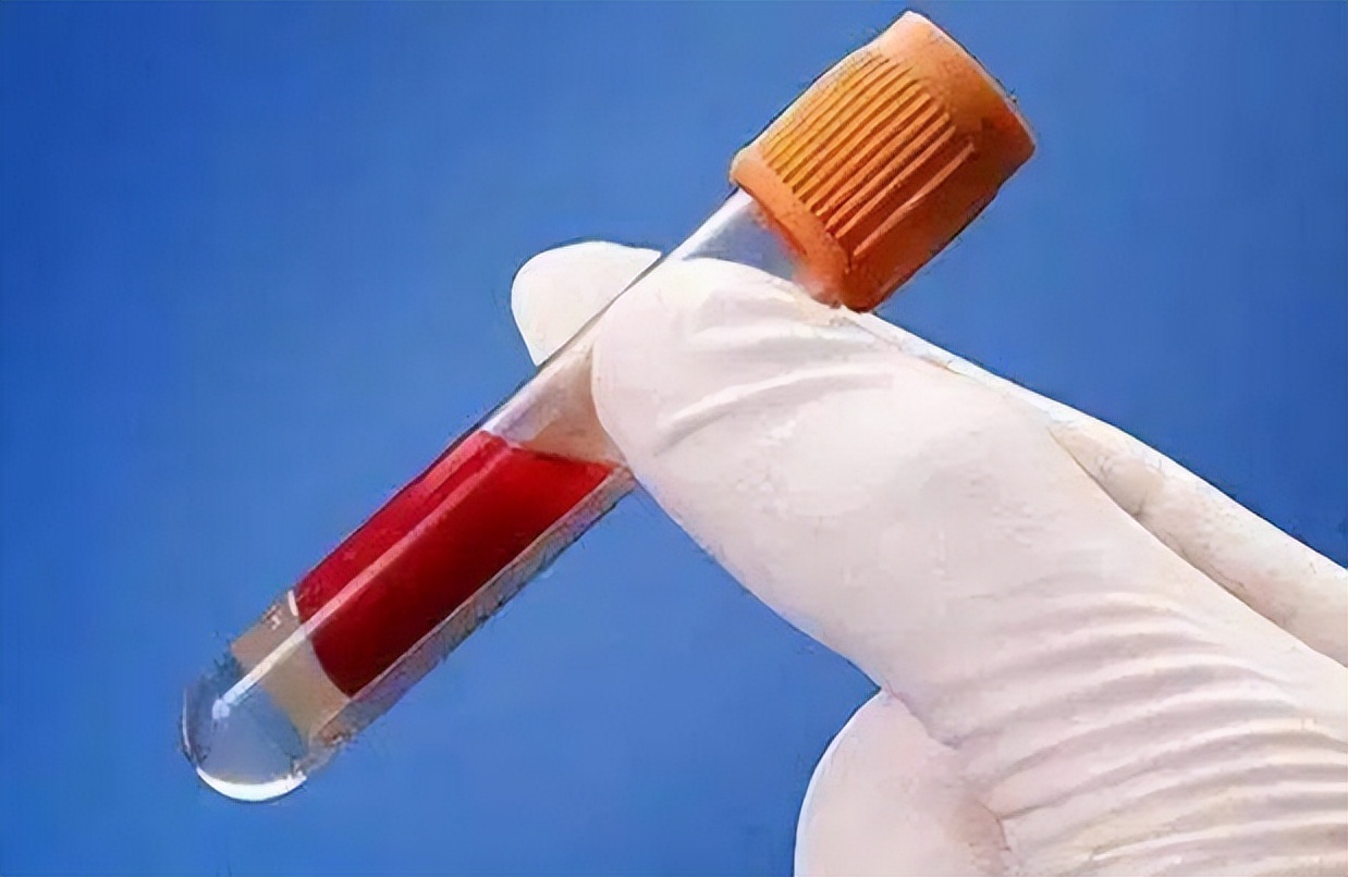 In the blood routine examination, if these three indicators are ...