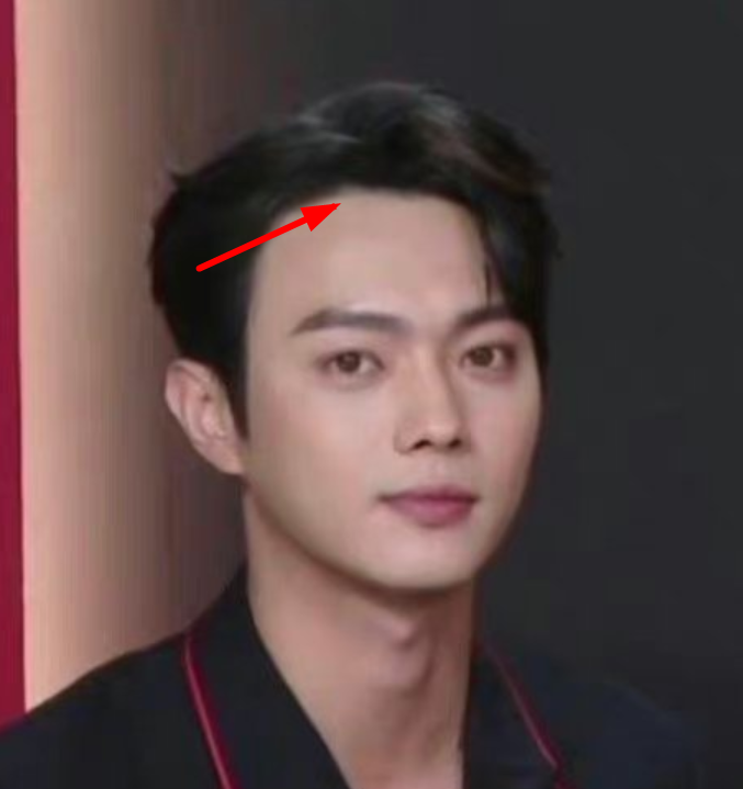 27-year-old Xu Kai is about to go bald, and his hairline looks like Yang Mi. The idol drama of ...