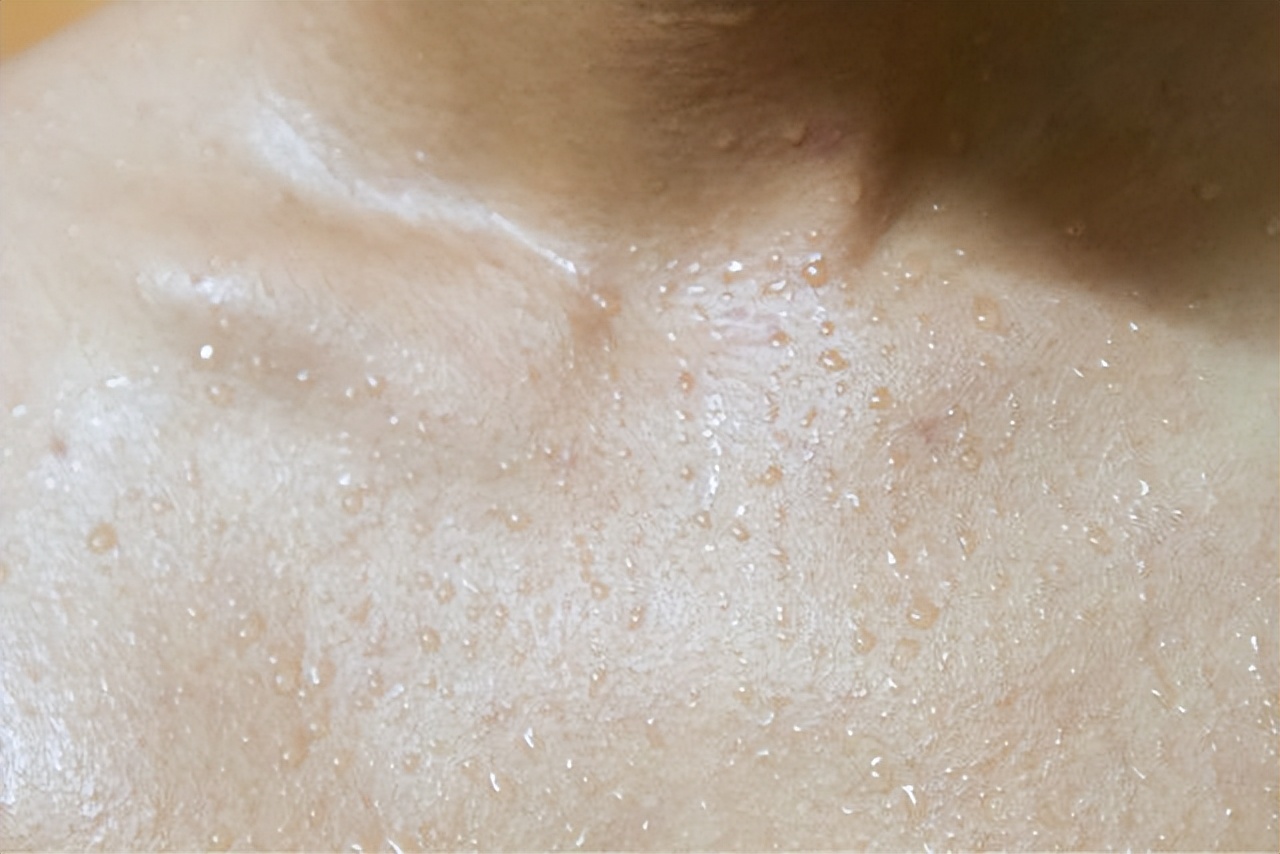 Private parts have "taste"?Doctor's reminder: This odor may be an early ...