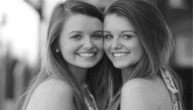 The Chinese Siamese brothers became famous for their performances ...