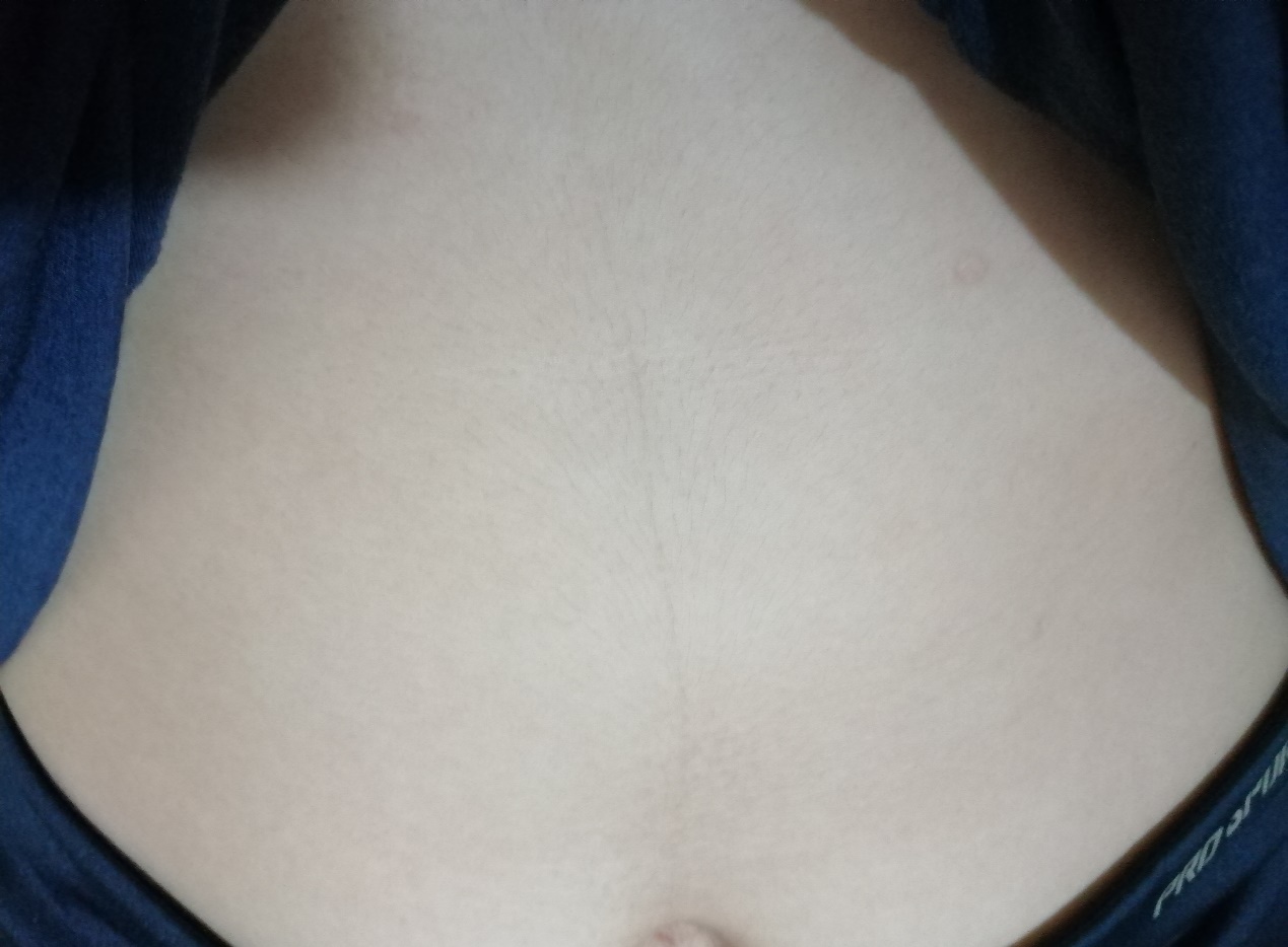 The black line on the belly of pregnant women is becoming more and more ...