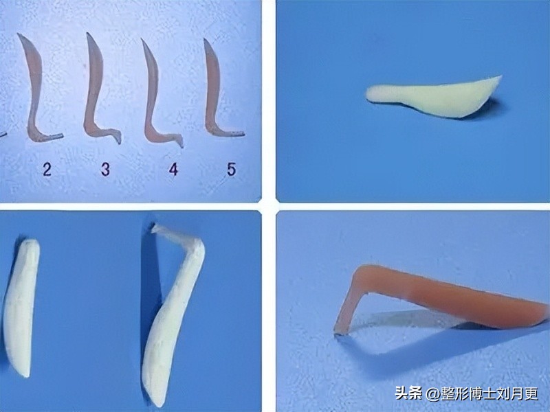 How to choose common rhinoplasty materials?What material is suitable ...