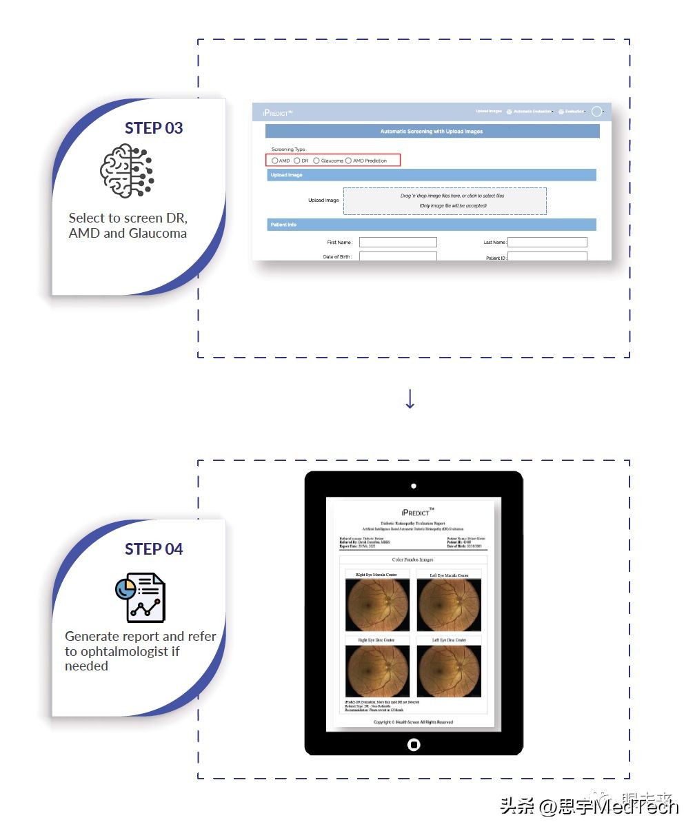 It only takes 5 minutes! Artificial Intelligence Eye Screening System ...
