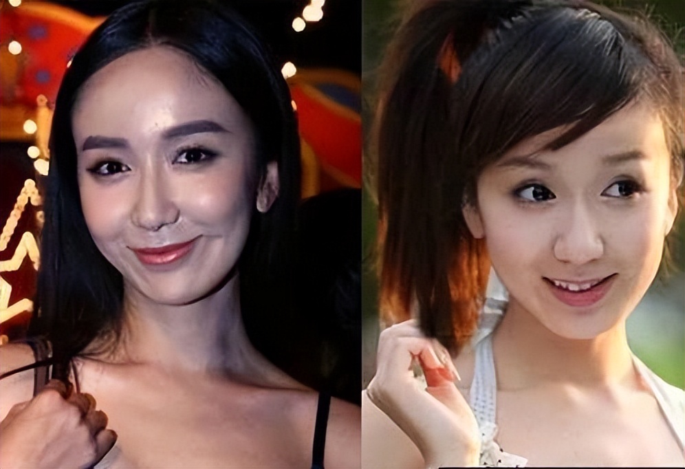 Do people who have plastic surgery change their appearance?Is it ...