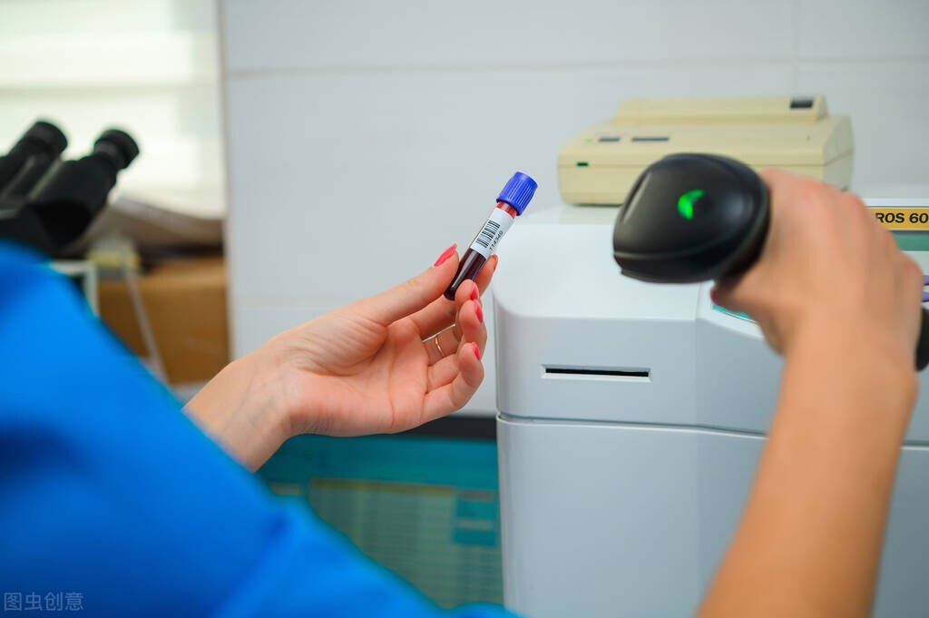 Can blood exchange really reverse aging?Scientists express doubts ...