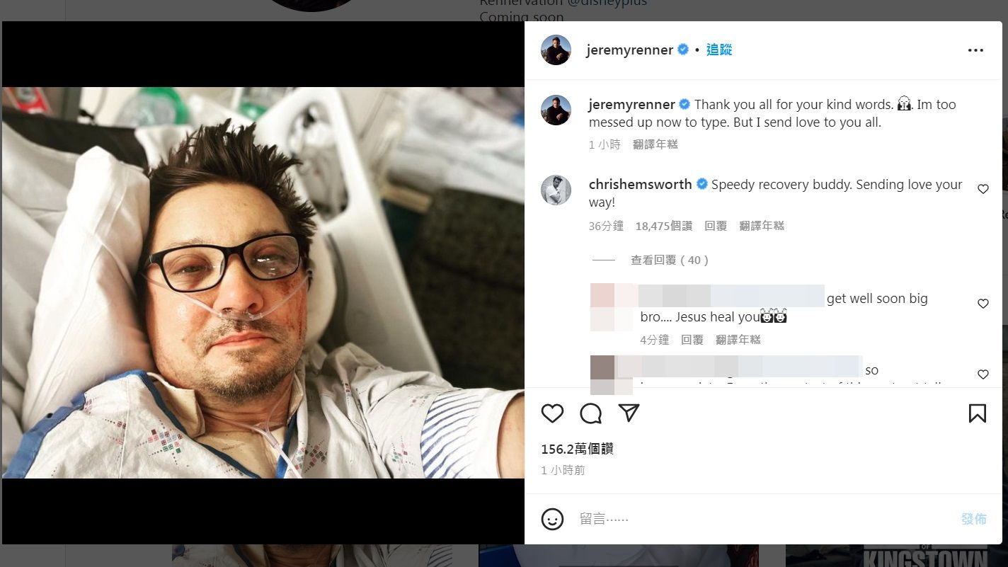 Hawkeye Jeremy Renner made his debut!Face deformed and shocked to see ...