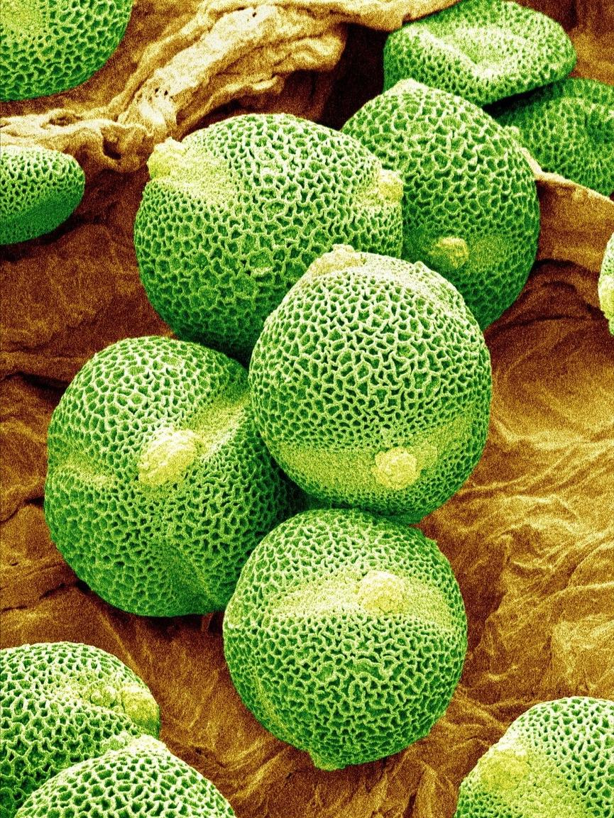 This is what flowers, stamens, and pollen look like under the ...