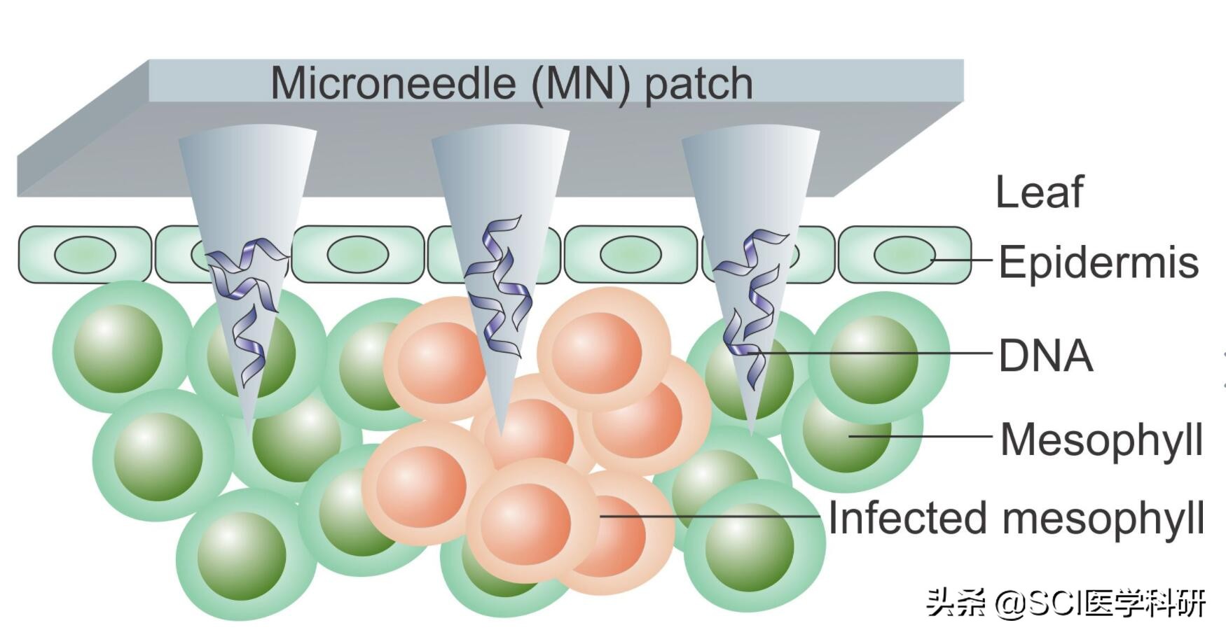Still afraid of injections and medicine?Microneedle patch is expected ...