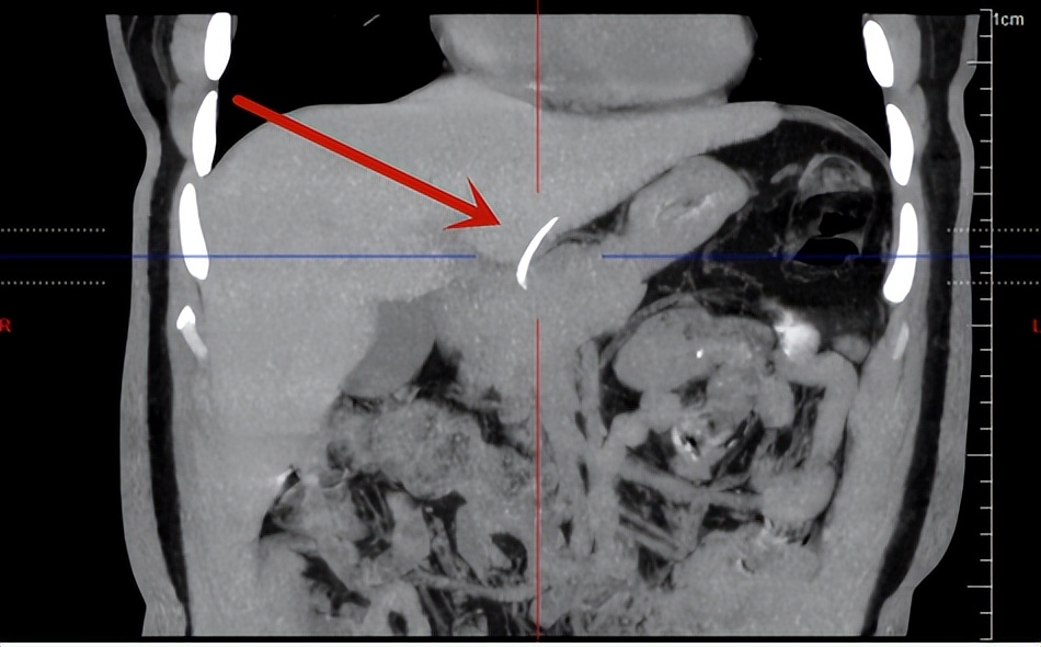 After 4 or 5 hours, I stabbed the fish with a knife, what happened? - iNEWS