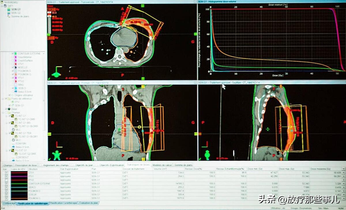 Radiation Therapy Planning System (TPS) third-party testing - iNEWS