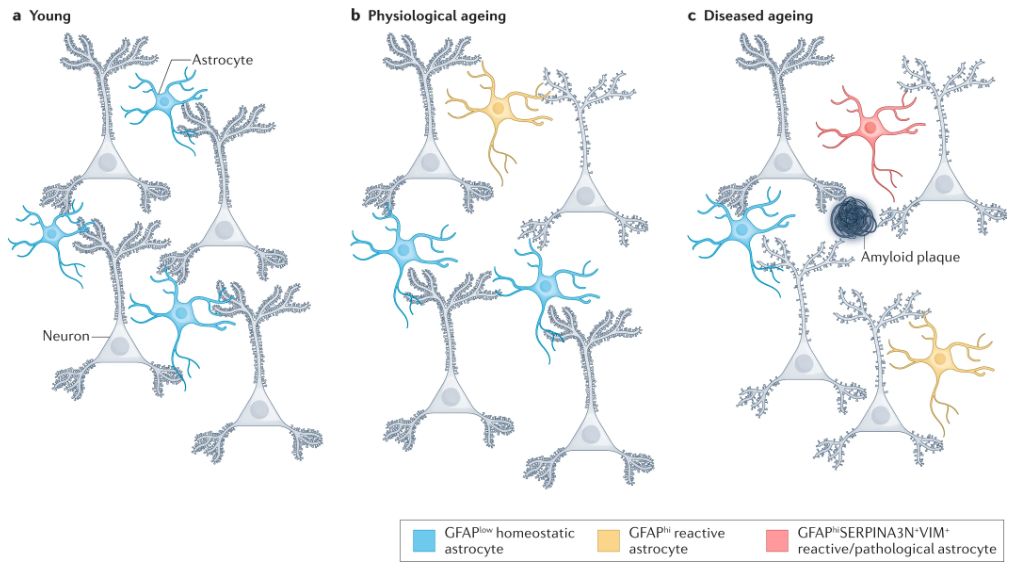 Sub-journal of Nature: The mechanism of action of astrocytes in AD, PD ...