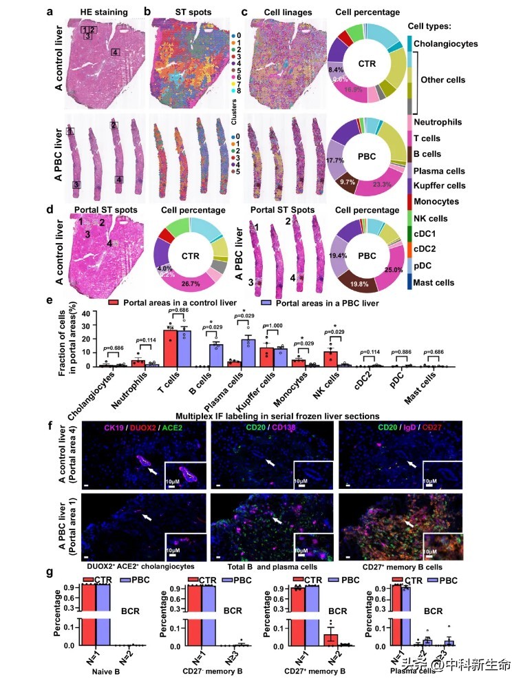 Blood 4D-DIA Proteome Project Article NC (IF 17.69) - iMedia
