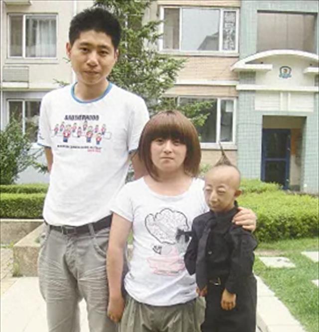 He Pingping, the "world's number one dwarf", passed away suddenly 10 ...
