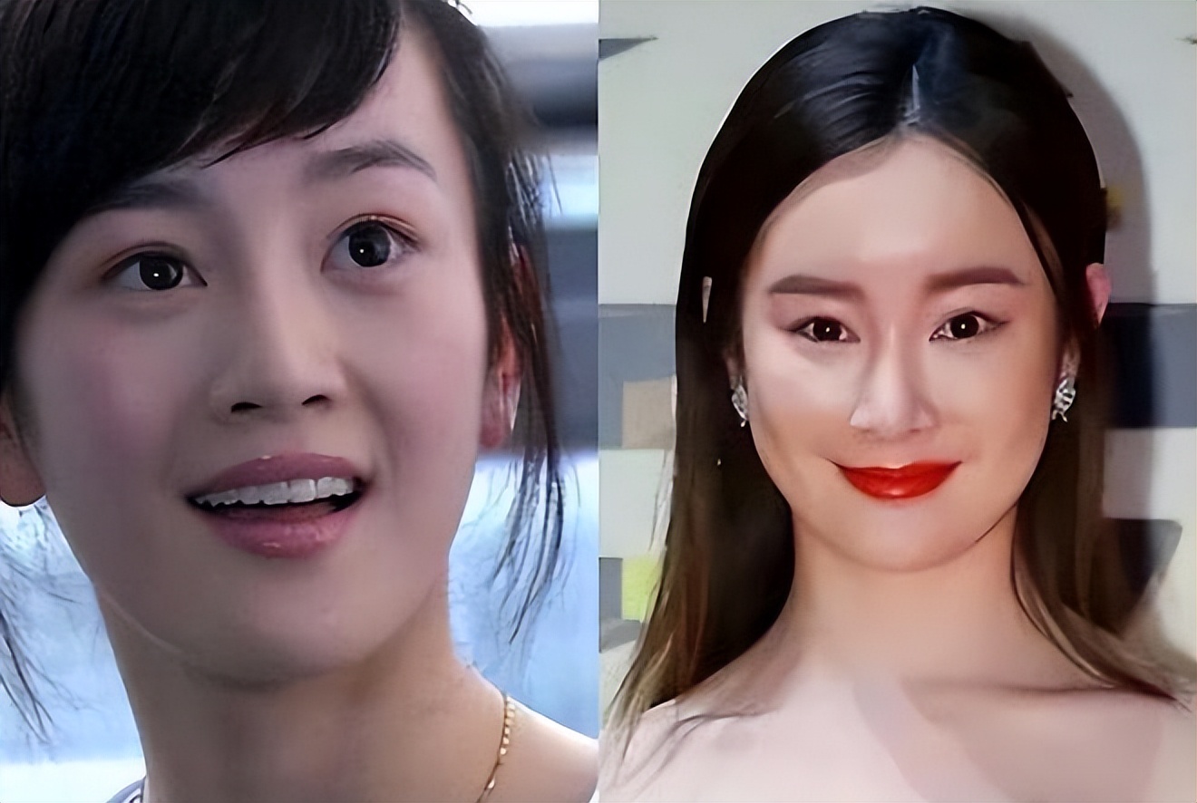 After taking out the prosthesis, Zhang Meng's appearance rejuvenated ...