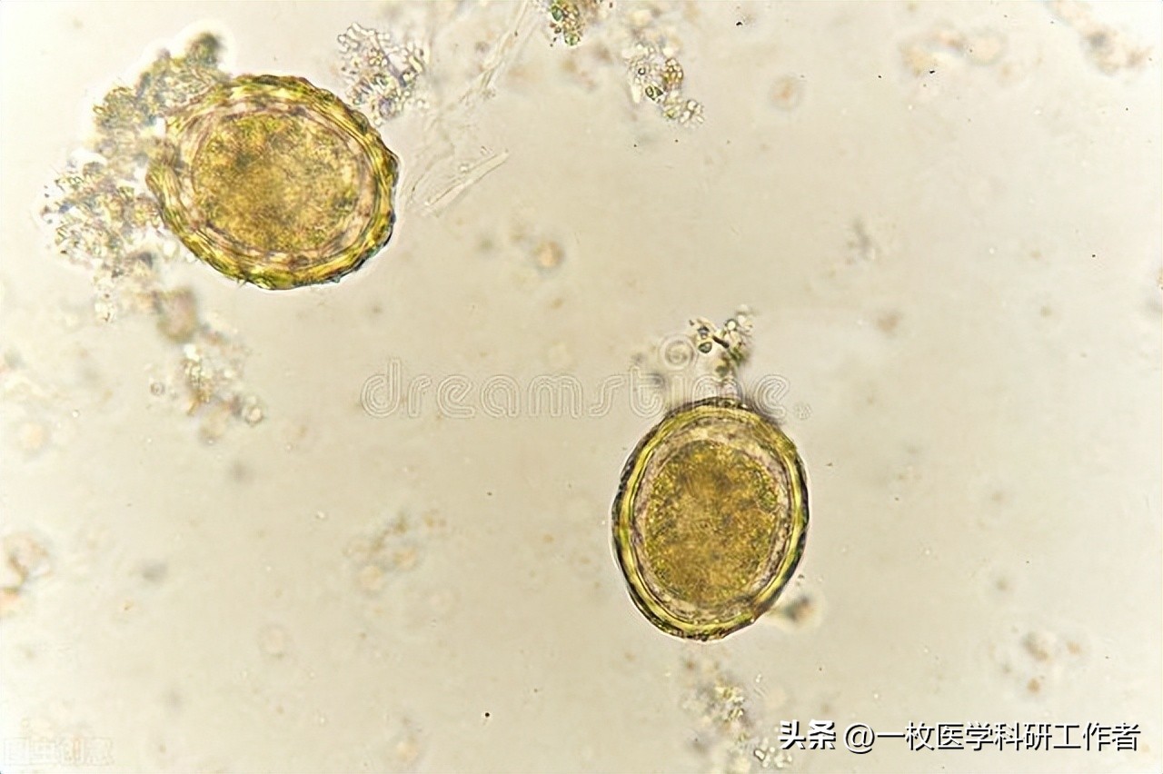 A variety of more serious stool abnormalities, check to see which ...