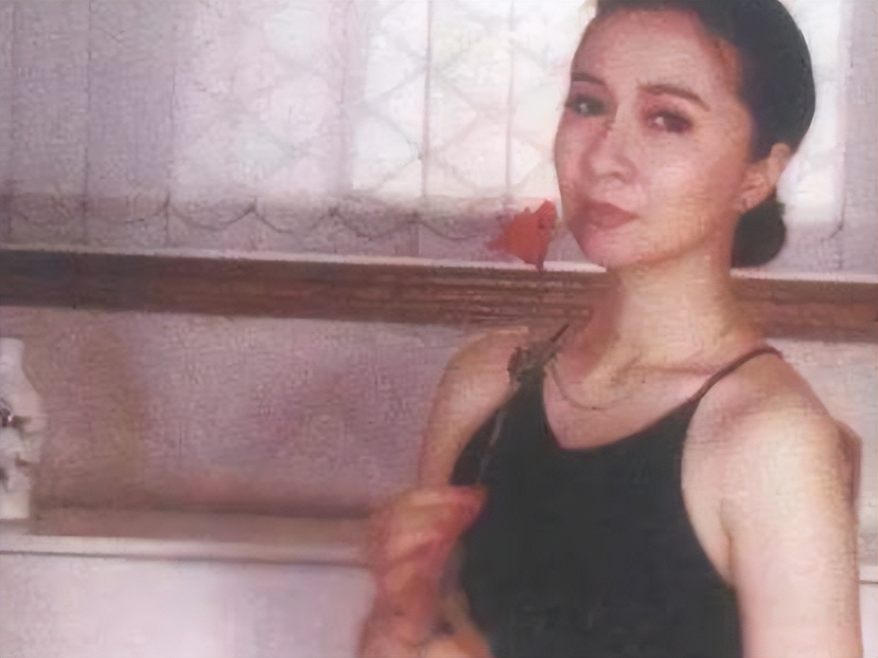 The end of plastic surgery is Cai Ming, what happened to Cai Ming with ...