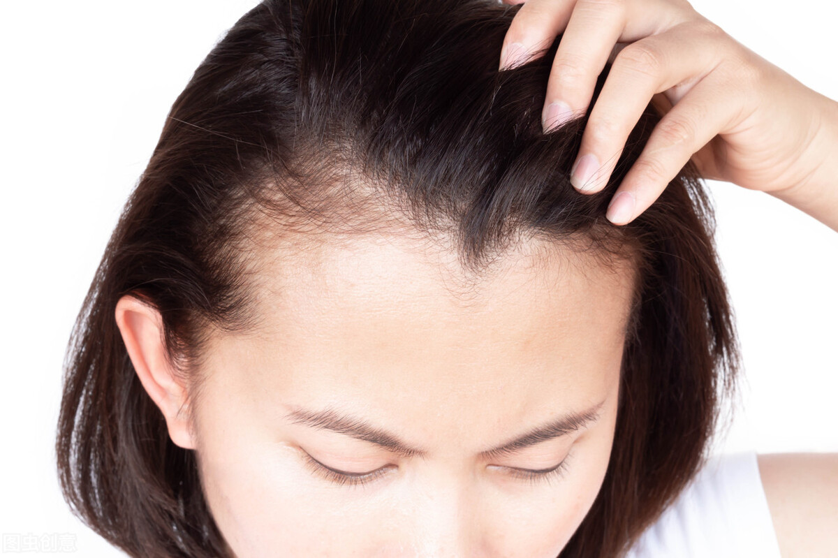 How to treat hair loss effectively?A few reliable ways to teach you ...