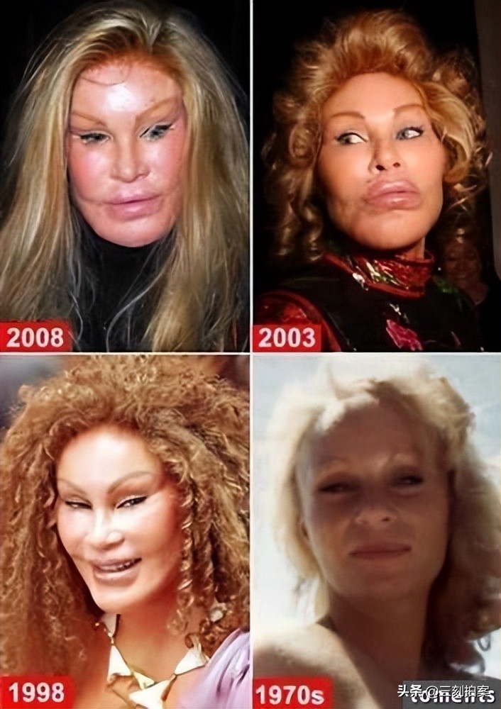 Addicted to cosmetic surgery?but also easy to fail - iNEWS