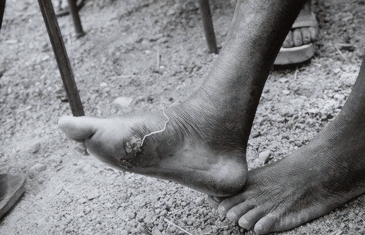 What is the dreaded dragon nematode?The high probability that the ...