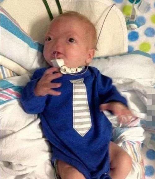 The little girl was born without a nose, and her father planned to ...