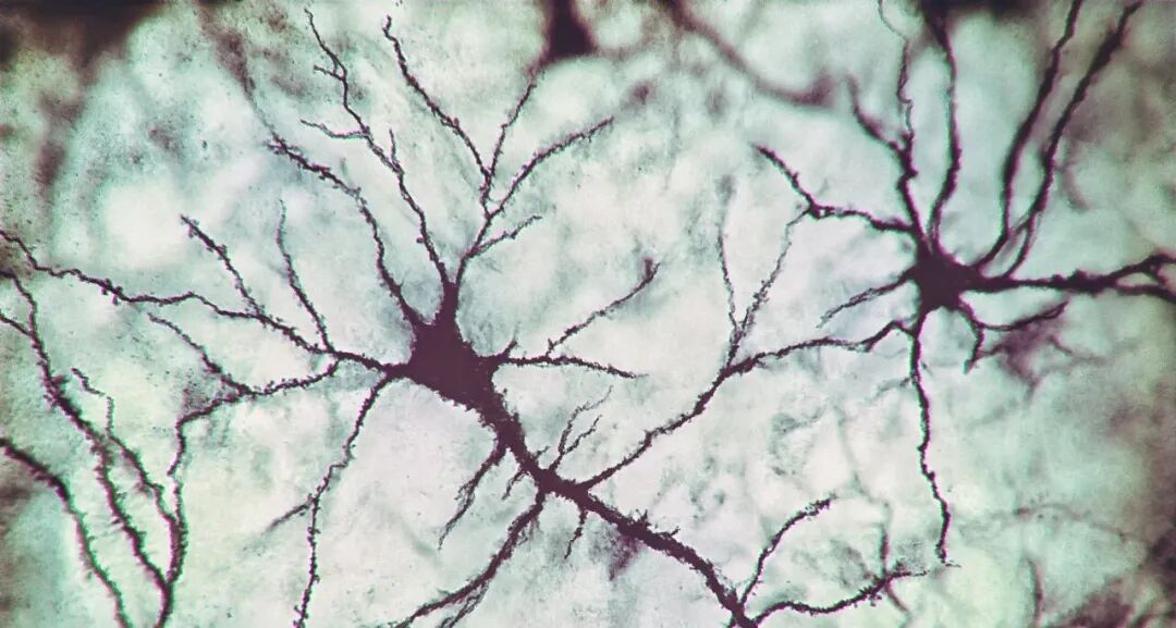 Cell: Scientists reveal the key to psilocybin's ability to reshape ...
