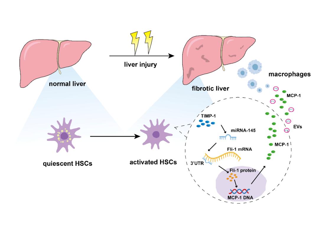 The important role of TIMP-1 in macrophage recruitment in liver ...