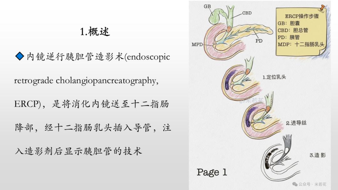 A Complete Guide to ERCP Anesthesia Management: From Preoperative ...